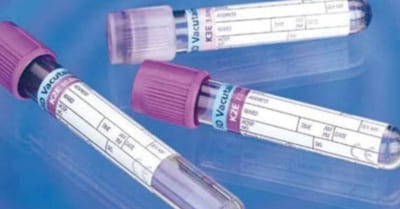 Evacuated Blood Tubes | Phlebotomy | Fisher Scientific